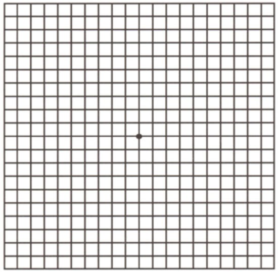 Makula-Degeneration - Dr. med. Wähning | Dr. med. Wähning
